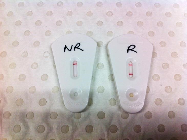 Faint Line On Hiv Test Strip at George Tarenorerer blog